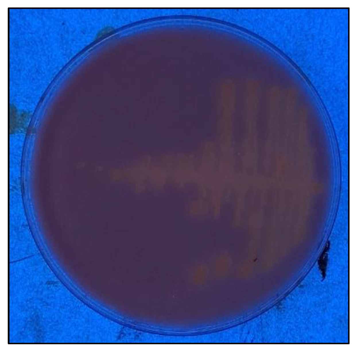 Gene Cloning, Characterization and Transesterification Reactions of Mgl ...