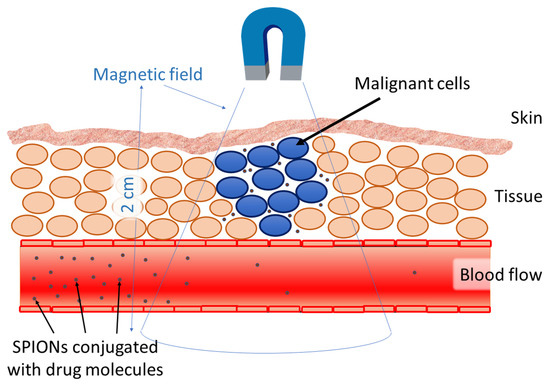 Magnetic Nanoparticles for Biomedical Purposes: Modern Trends and Prospects