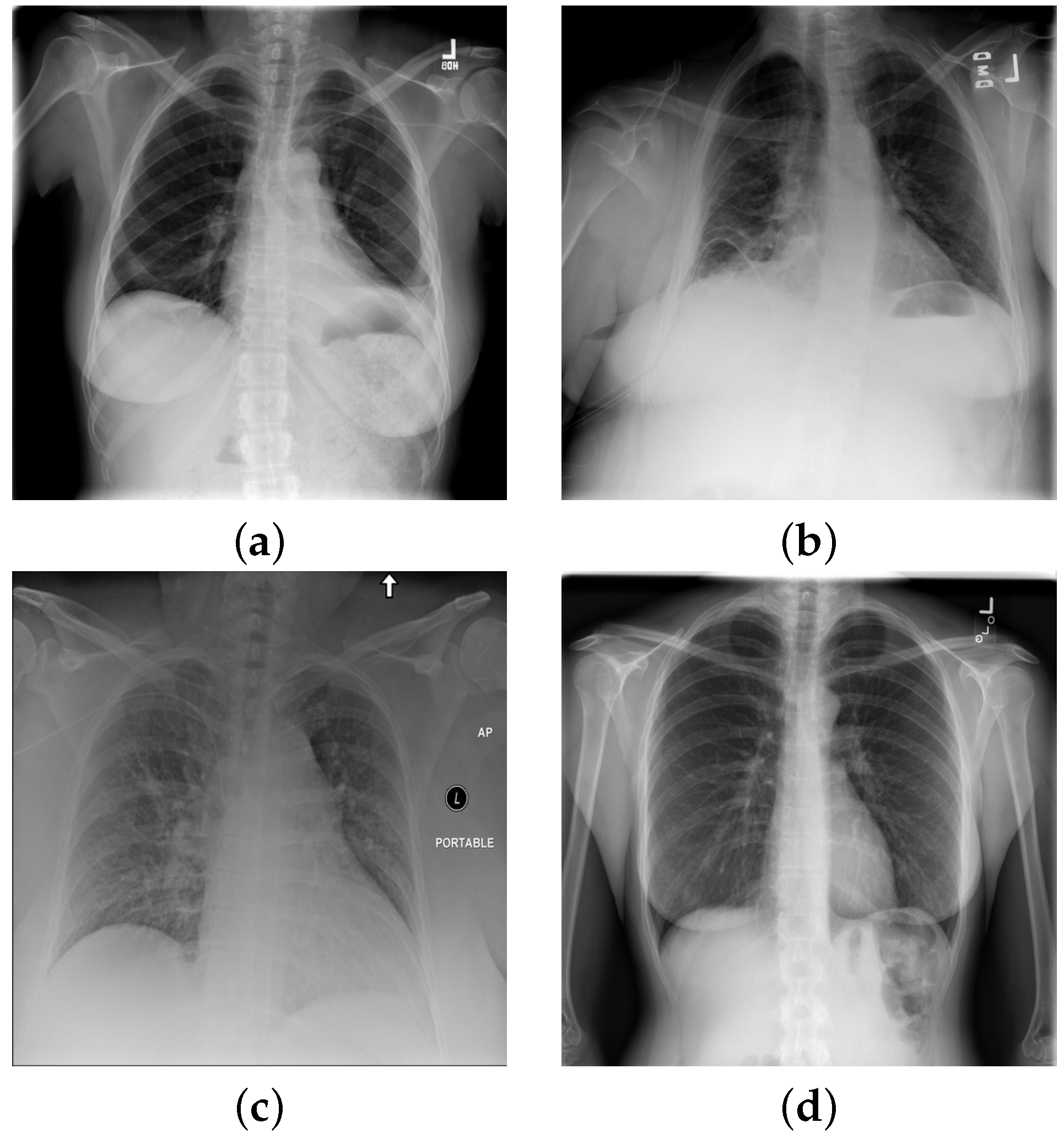 Advanced Multi-Label Image Classification Techniques Using Ensemble Methods