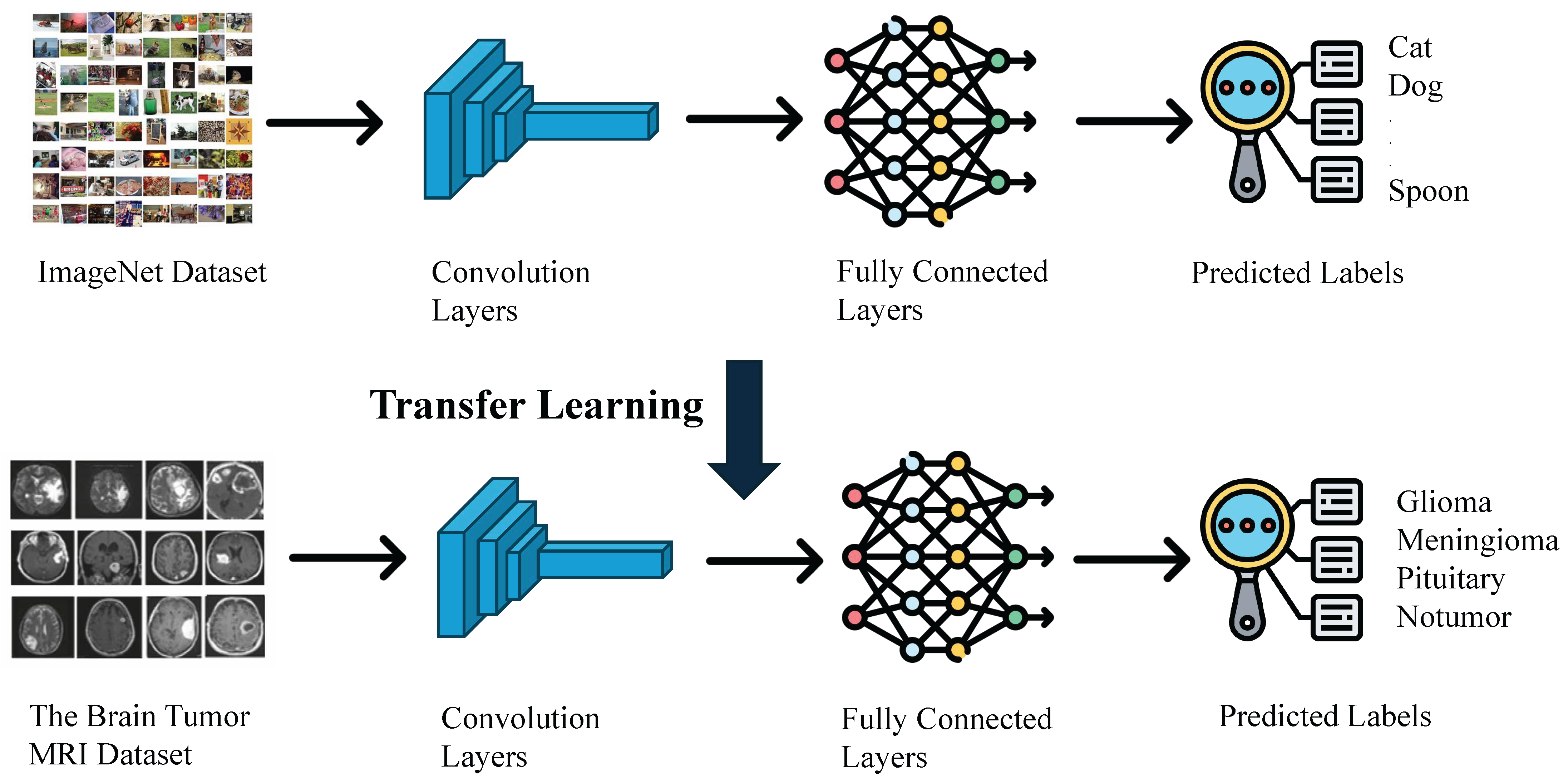 Empowering Brain Tumor Diagnosis through Explainable Deep Learning