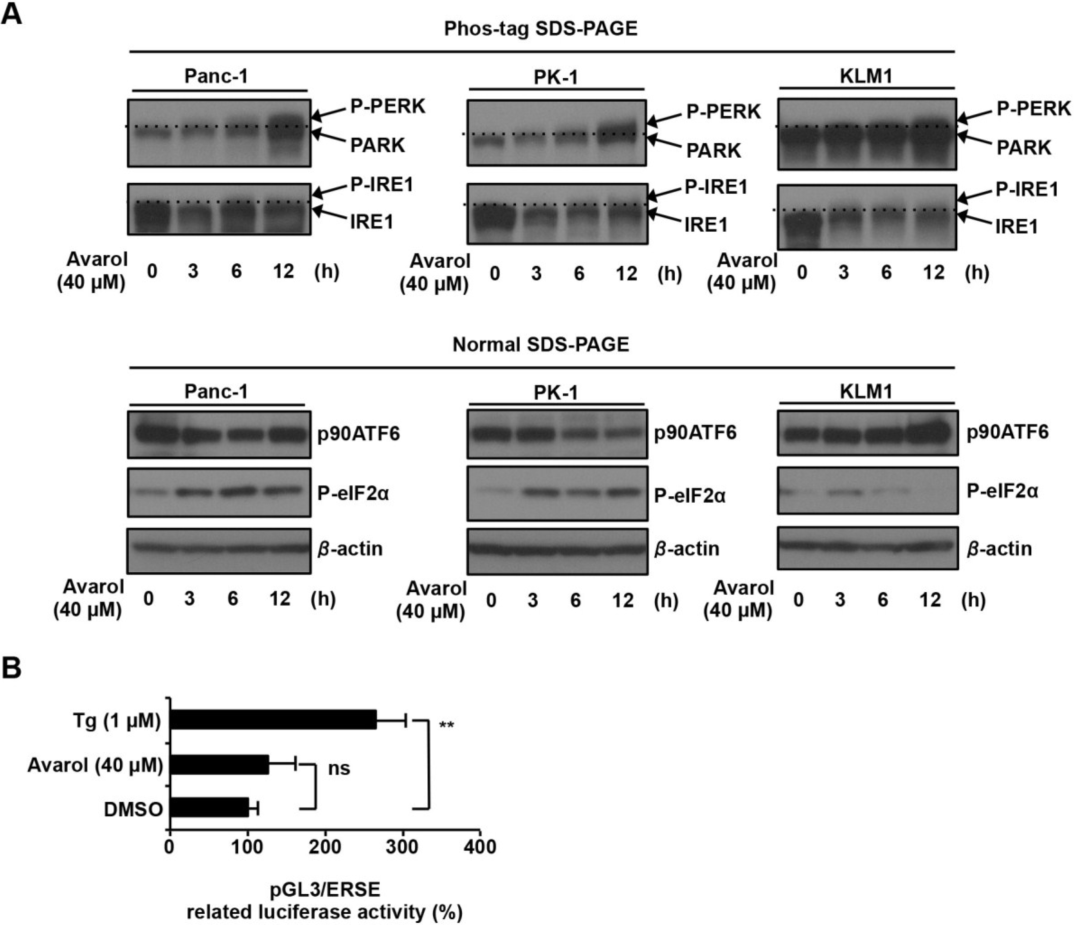 Avarol Induces Apoptosis in Pancreatic Ductal Adenocarcinoma Cells by ...