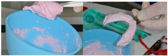 Alginate Materials and Dental Impression Technique: A Current State of ...