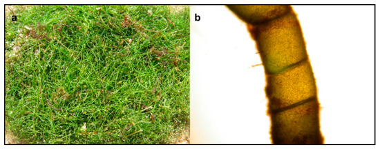 Screening of Chaetomorpha linum Lipidic Extract as a New Potential ...