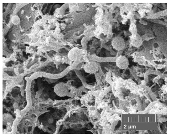 Biotechnological and Ecological Potential of Micromonospora ...