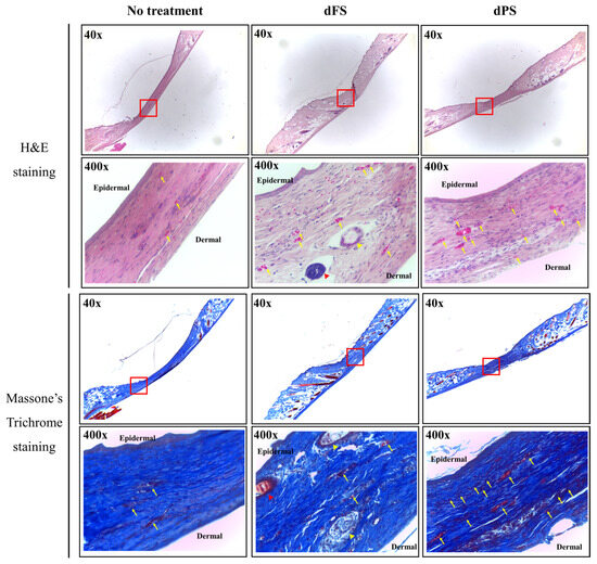 Therapeutic Effect of Decellularized Extracellular Matrix from Fish ...