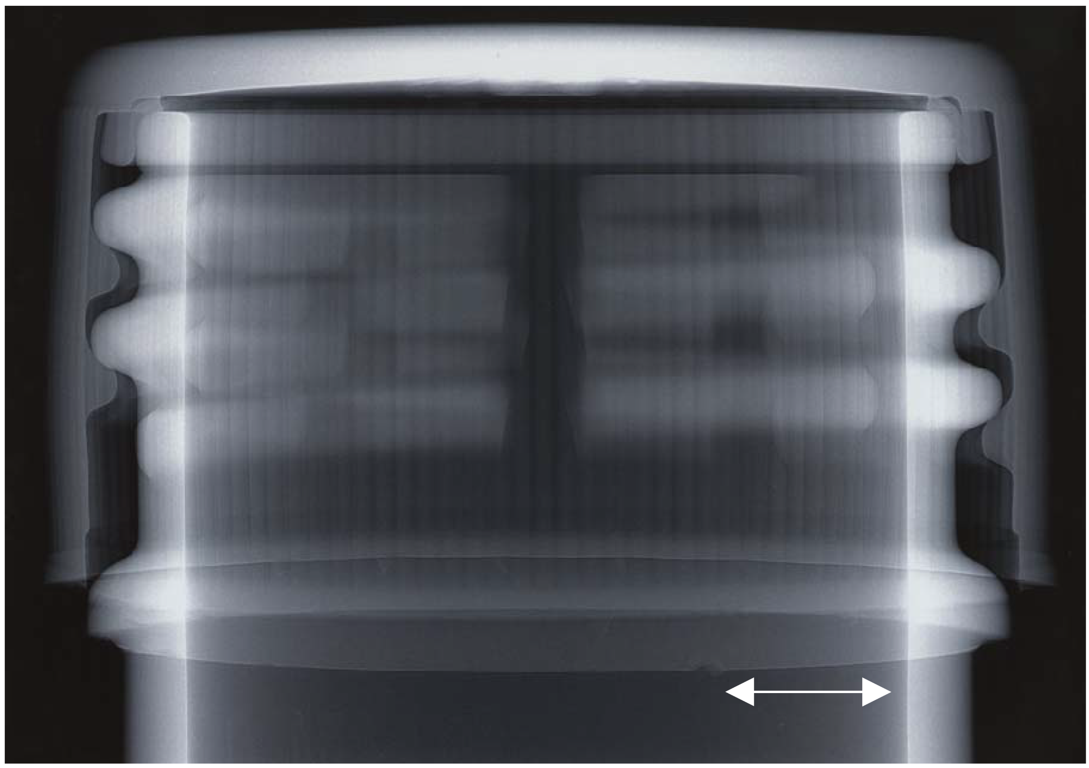 In-Line Phase-Contrast X-ray Imaging and Tomography for Materials Science