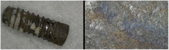 Materials | Free Full-Text | Titanium Corrosion Mechanisms in the Oral ...