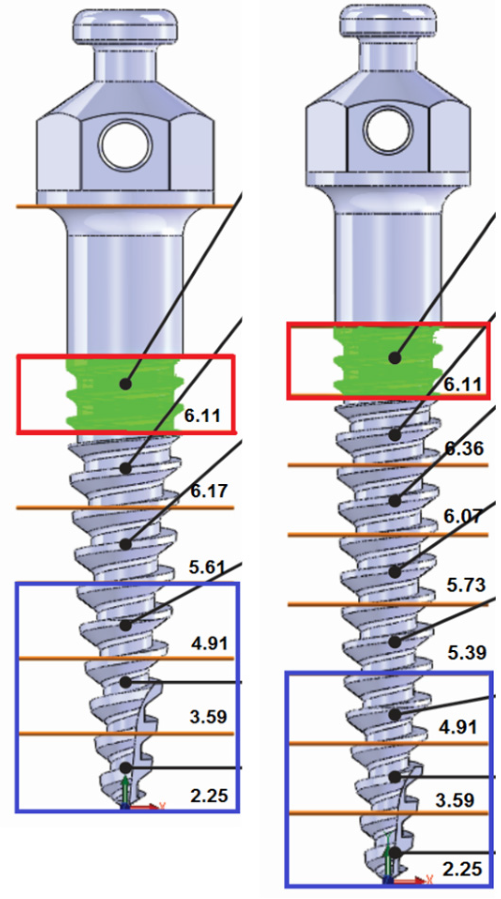 Influence of Screw Length and Bone Thickness on the Stability of ...