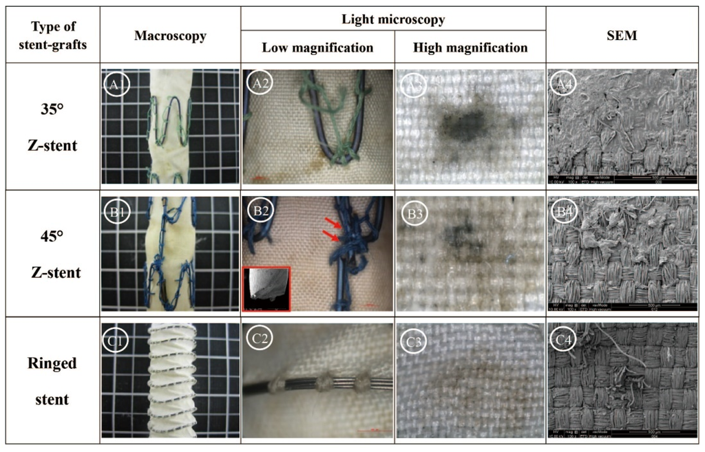 An in Vitro Twist Fatigue Test of Fabric Stent-Grafts Supported by Z ...
