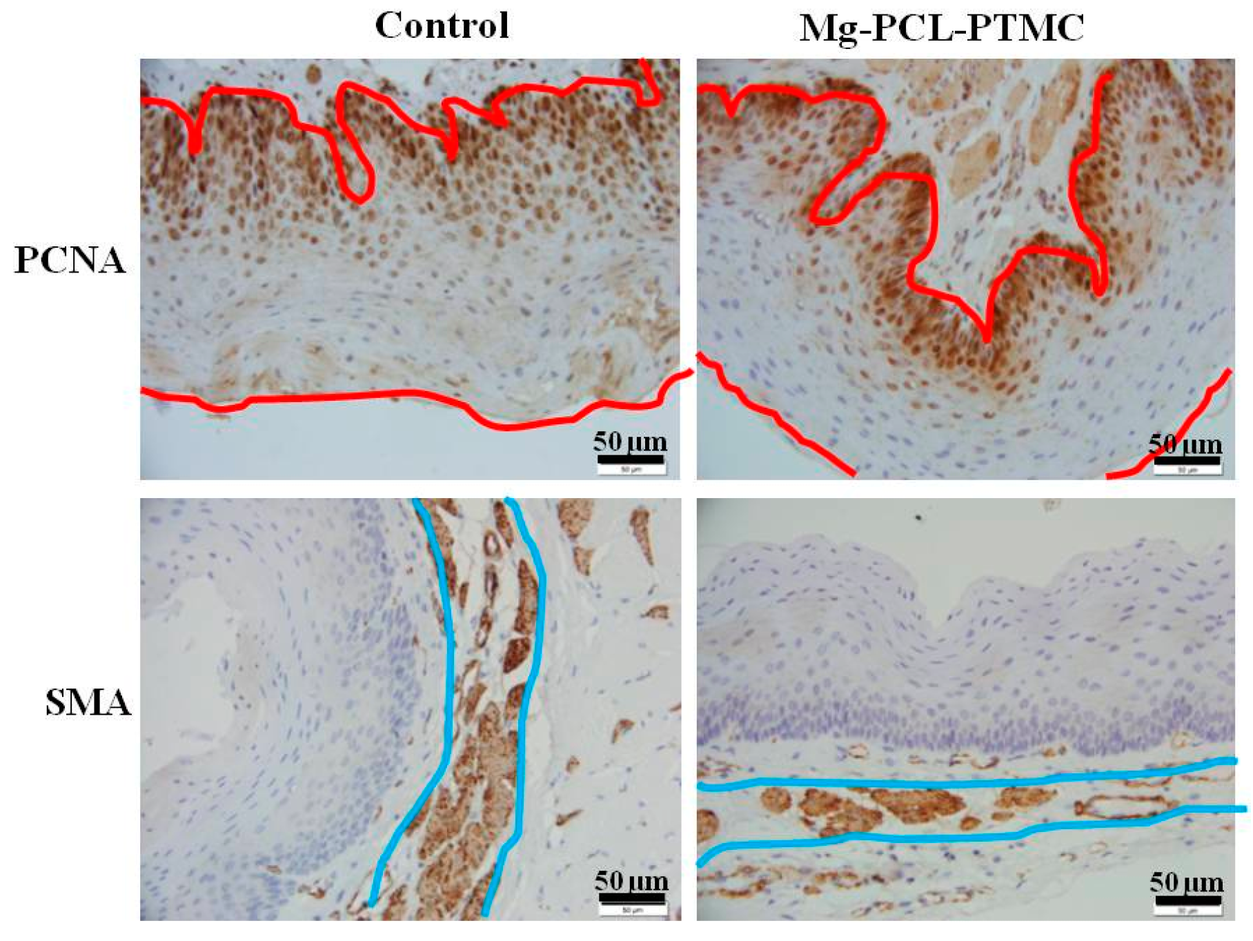 Fabrication of a Delaying Biodegradable Magnesium Alloy-Based ...
