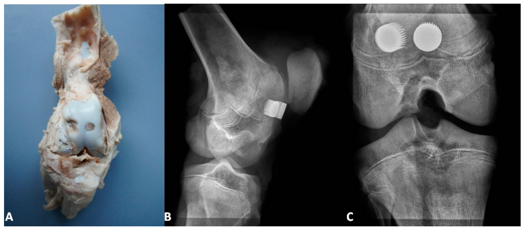 Materials | Special Issue : Metallic Scaffolds for Bone Regeneration