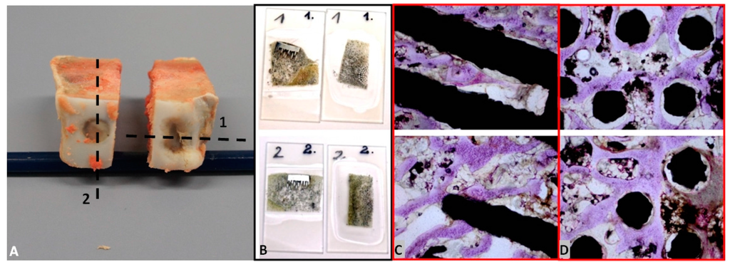 Materials | Special Issue : Metallic Scaffolds for Bone Regeneration