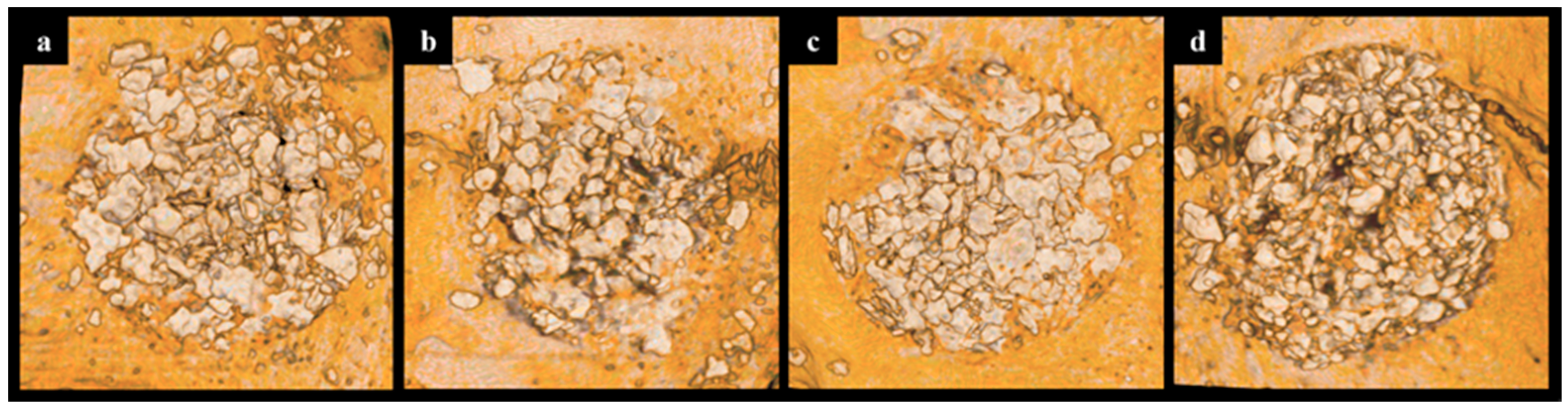 The Effect of Bisphasic Calcium Phosphate Block Bone Graft Materials ...