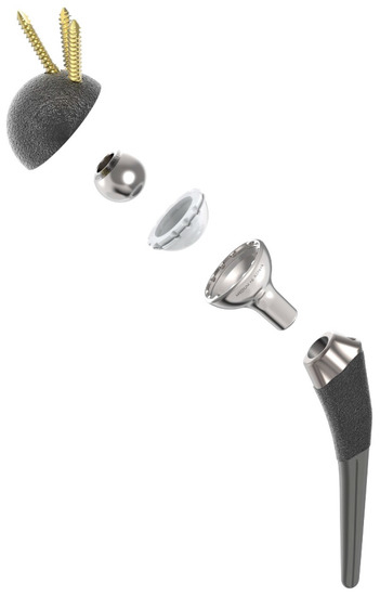 Corrosion and Tribology of Materials Used in a Novel Reverse Hip ...