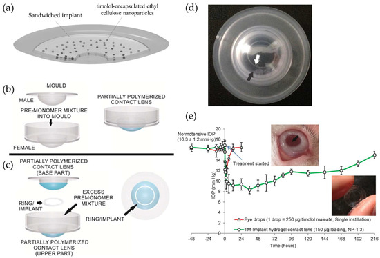 Therapeutic Contact Lenses with Polymeric Vehicles for Ocular Drug ...