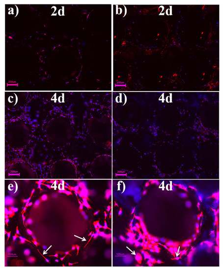 Materials | Special Issue : Bioceramics: Bioinert, Bioactive, and Coatings
