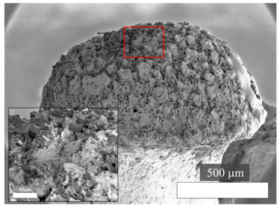 3D Imaging of Indentation Damage in Bone