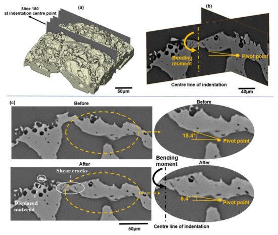 3D Imaging of Indentation Damage in Bone