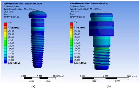 FEM Analysis of Dental Implant-Abutment Interface Overdenture ...