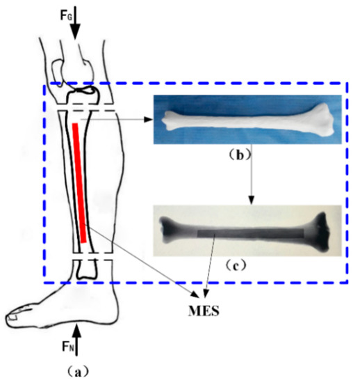 Applications and Advances of Magnetoelastic Sensors in Biomedical ...