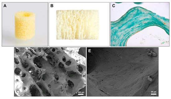 Bone Augmentation and Simultaneous Implant Placement with Allogenic ...