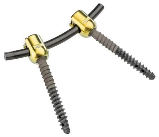 Biomechanical Study of a Novel, Expandable, Non-Metallic and ...