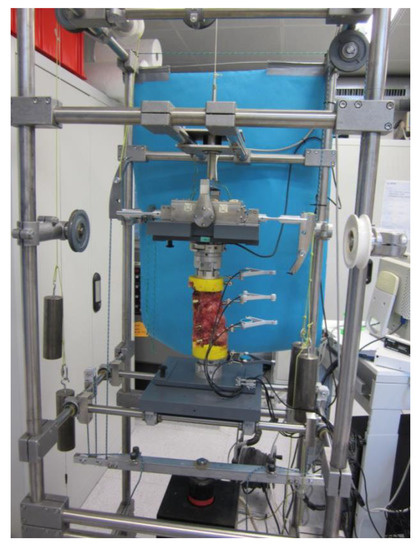 Biomechanical Study of a Novel, Expandable, Non-Metallic and ...