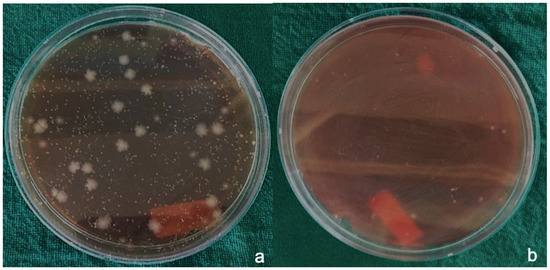 Bacterial Adherence Around Sutures of Different Material at Grafted ...