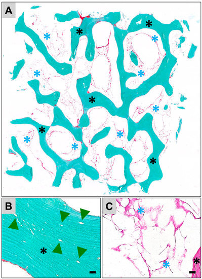 Balancing Purification and Ultrastructure of Naturally Derived Bone ...