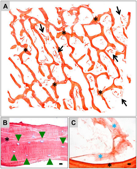 Balancing Purification and Ultrastructure of Naturally Derived Bone ...