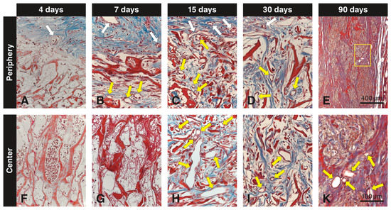 Tissue Response to a Porous Collagen Matrix Used for Soft Tissue ...