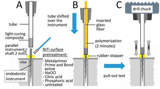 Removing Fractured Endodontic NiTi Instruments with a Tube Technique ...