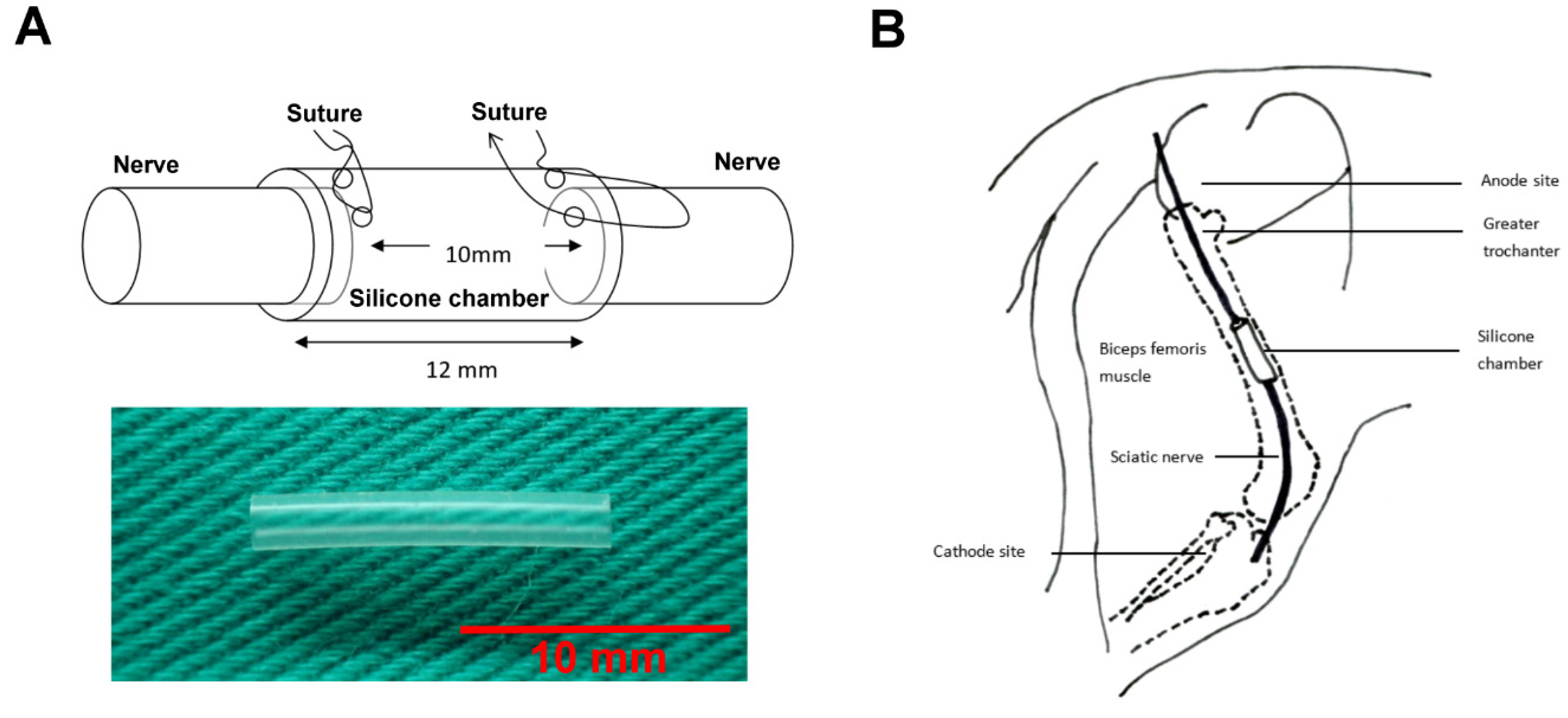 Effects of Electrical Stimulation on Peripheral Nerve Regeneration in a ...