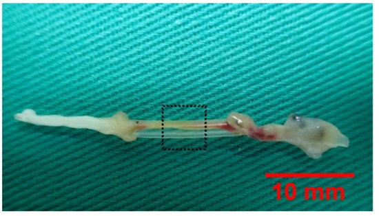 Effects of Electrical Stimulation on Peripheral Nerve Regeneration in a ...