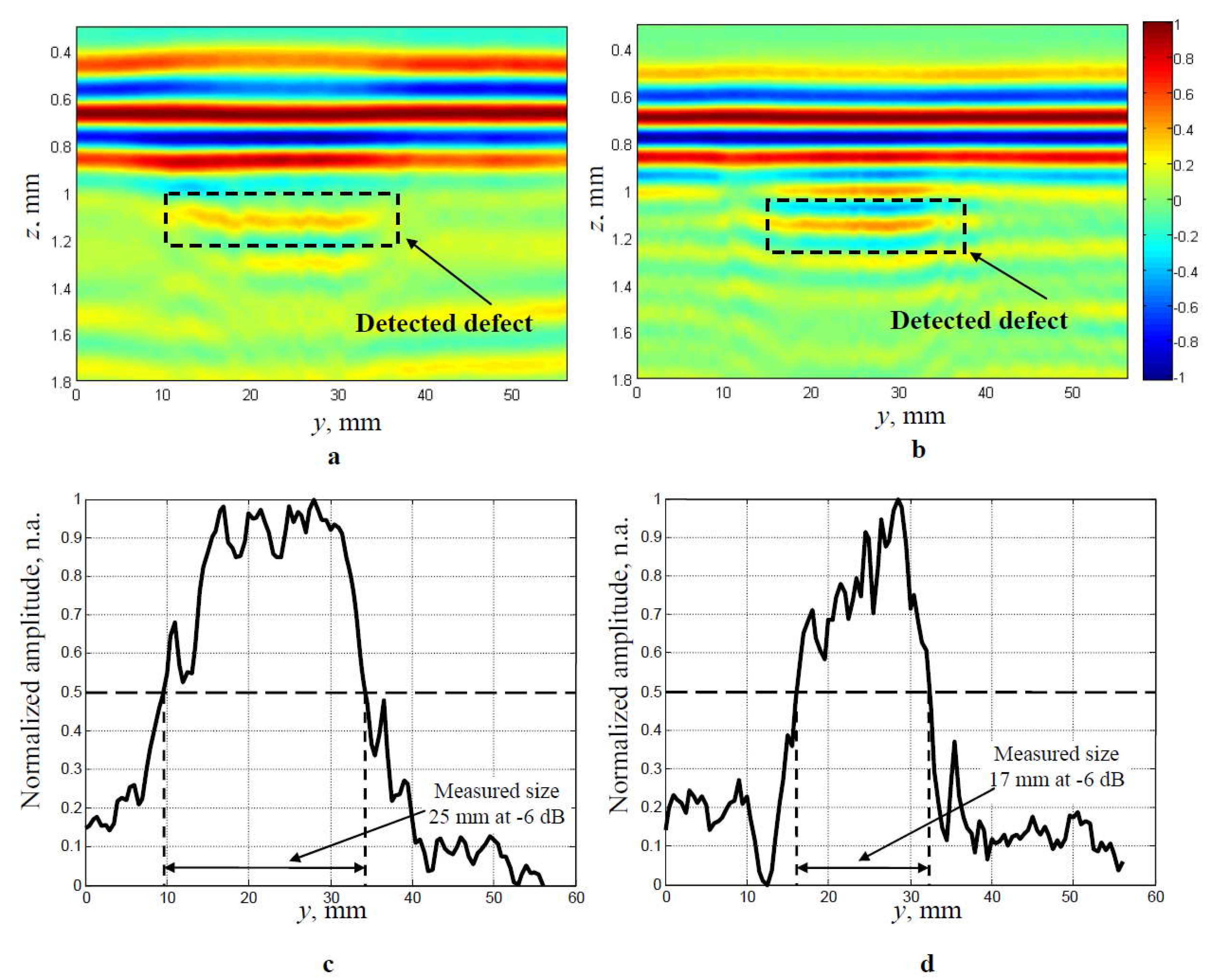 Application of Dual Focused Ultrasonic Phased Array Transducer in Two Orthogonal Cross-Sections ...