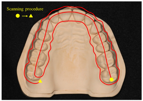 Effect of Tooth Types on the Accuracy of Dental 3D Scanners: An In ...