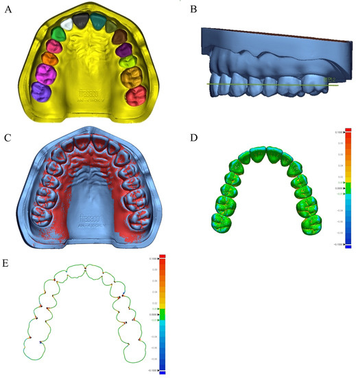 Effect of Tooth Types on the Accuracy of Dental 3D Scanners: An In ...
