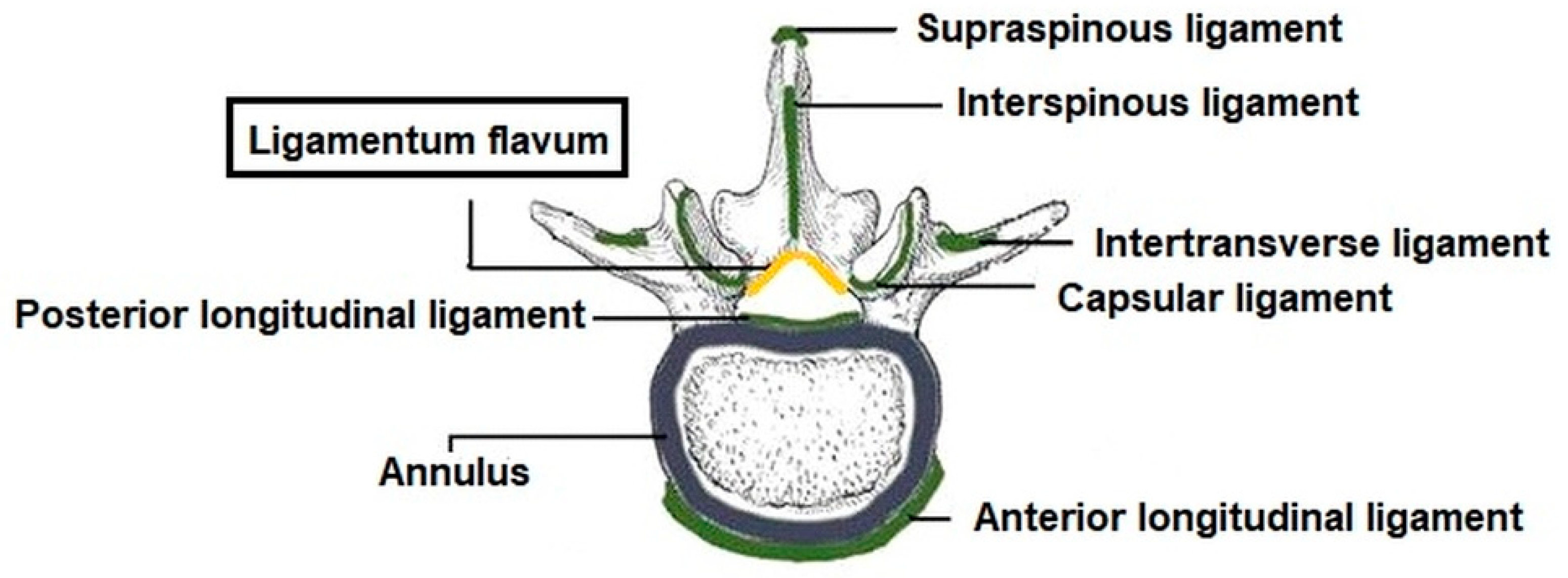 Model of Pathological Collagen Mineralization Based on Spine Ligament ...