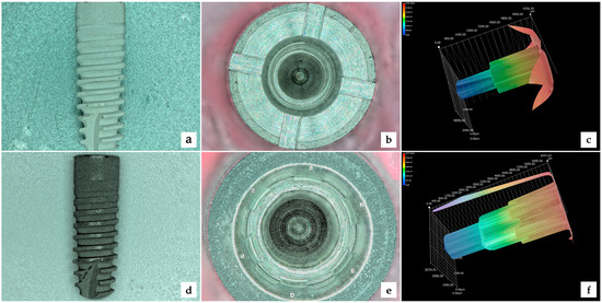 Volumetric Changes in Morse Taper Connections After Implant Placement ...