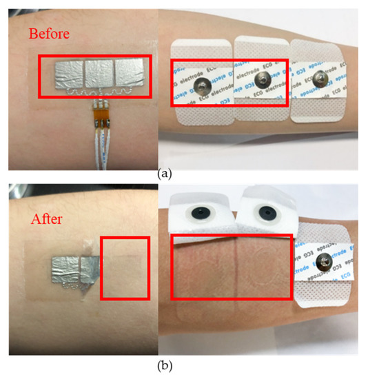Flexible Electrode by Hydrographic Printing for Surface ...