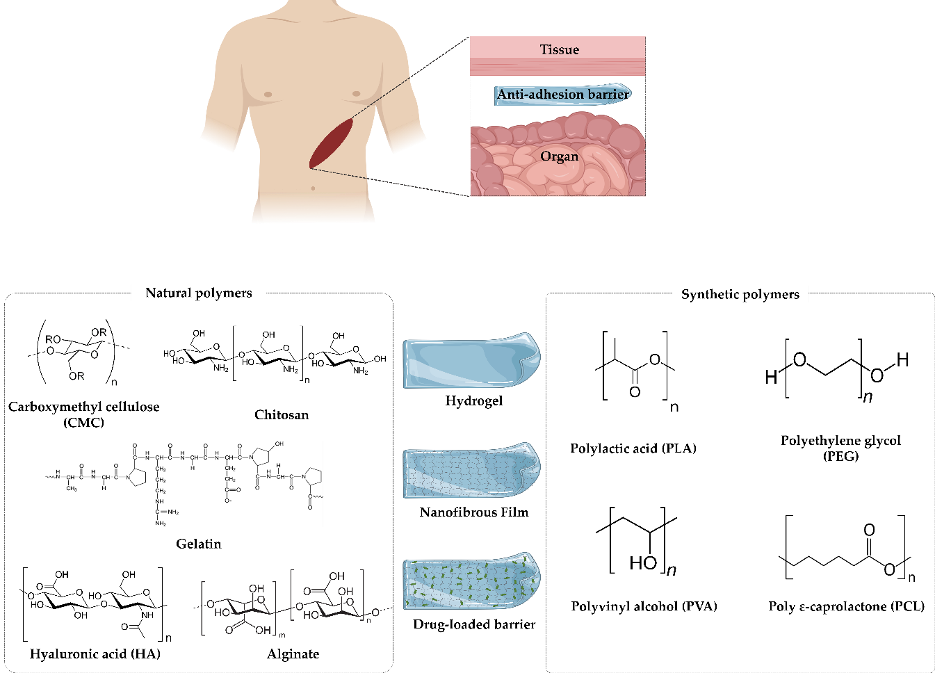 Materials | Free Full-Text | Biomaterials to Prevent Post-Operative ...