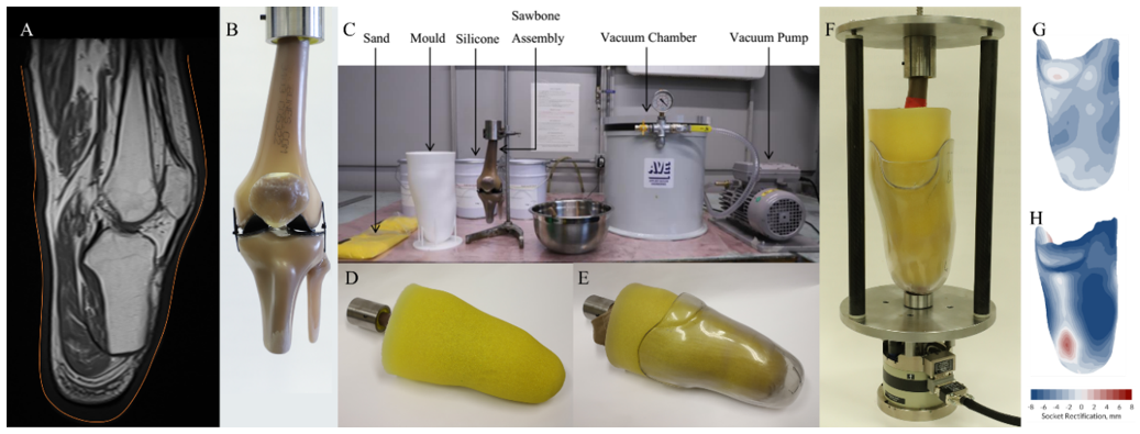 Developing an Analogue Residual Limb for Comparative DVC Analysis of ...