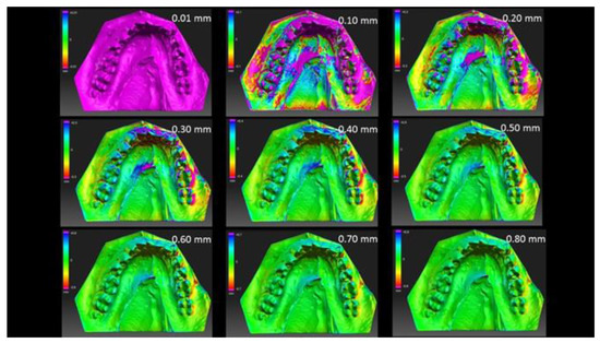 Comparison of Dental Stone Models and Their 3D Printed Acrylic Replicas ...