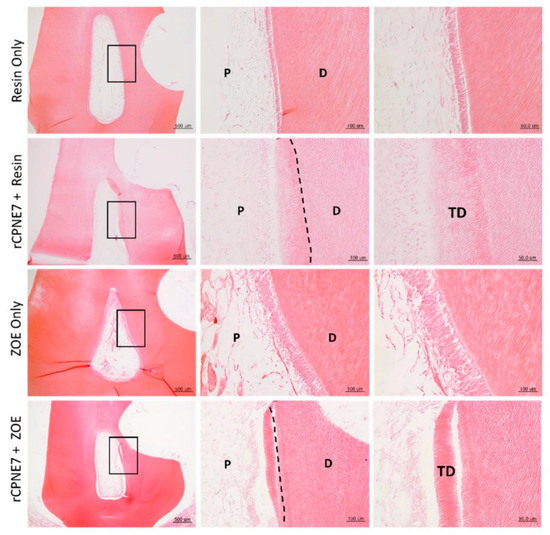 Tubular Dentin Regeneration Using a CPNE7-Derived Functional Peptide