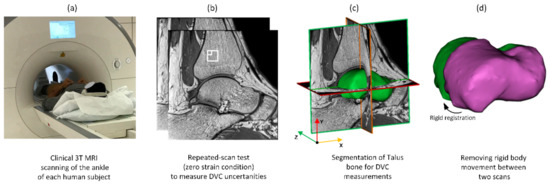 In Vivo Deformation and Strain Measurements in Human Bone Using Digital ...