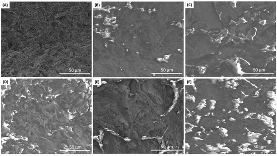 Titanium Corrosion in Peri-Implantitis