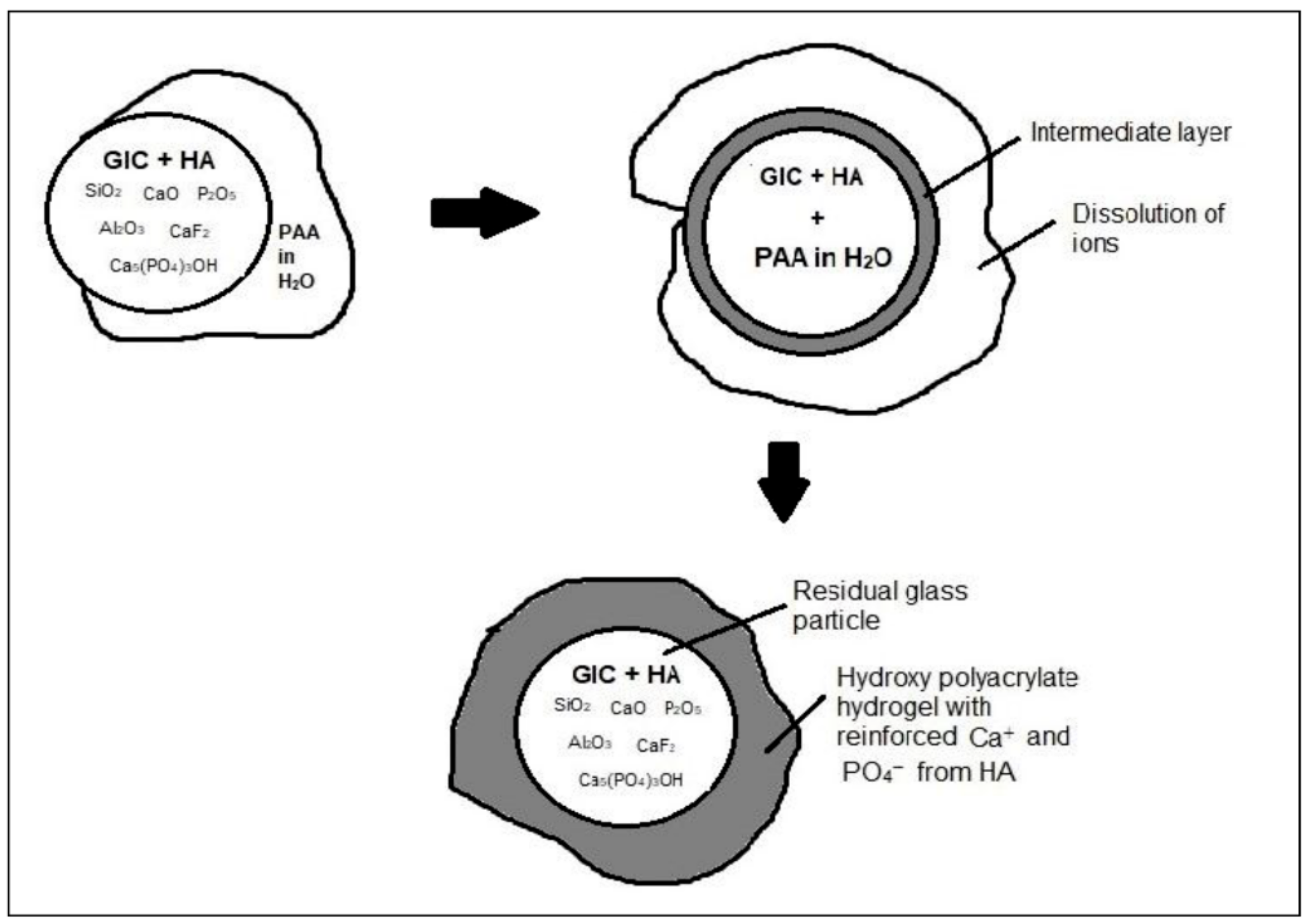 Setting reaction of glass ionomer cement store