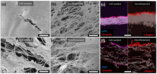 Improvement of the Electronic—Neuronal Interface by Natural Deposition ...