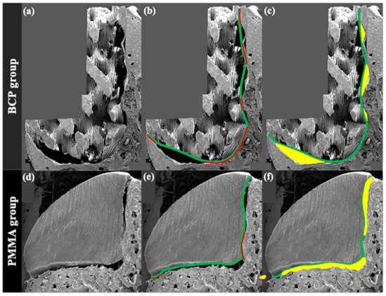 Scanning Electron Microscopic Evaluation of the Internal Fit Accuracy ...
