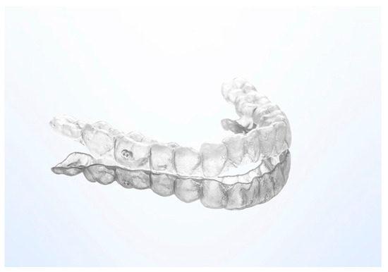 Direct 3D Printing of Clear Orthodontic Aligners: Current State and ...